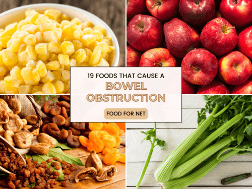 19 Foods That Reduce Swelling In Your Feet And Ankles | Food For Net