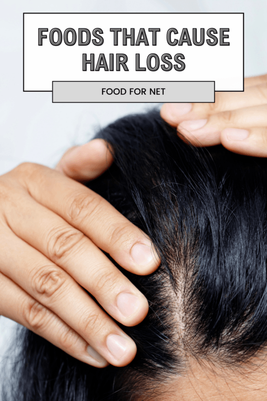 12 Foods That Cause Hair Loss And What You Can Do | Food For Net