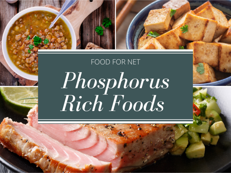 Food For Hyperacidity That Will Keep Your Stomach Calm | Food For Net